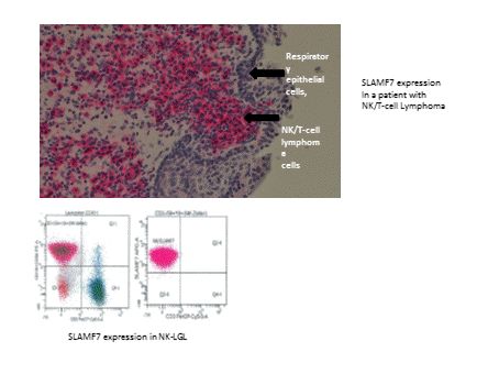 STRONG EXPRESSION OF SLAMF7 IN NATURAL KILLER/T-CELL LYMPHOMA AND ...